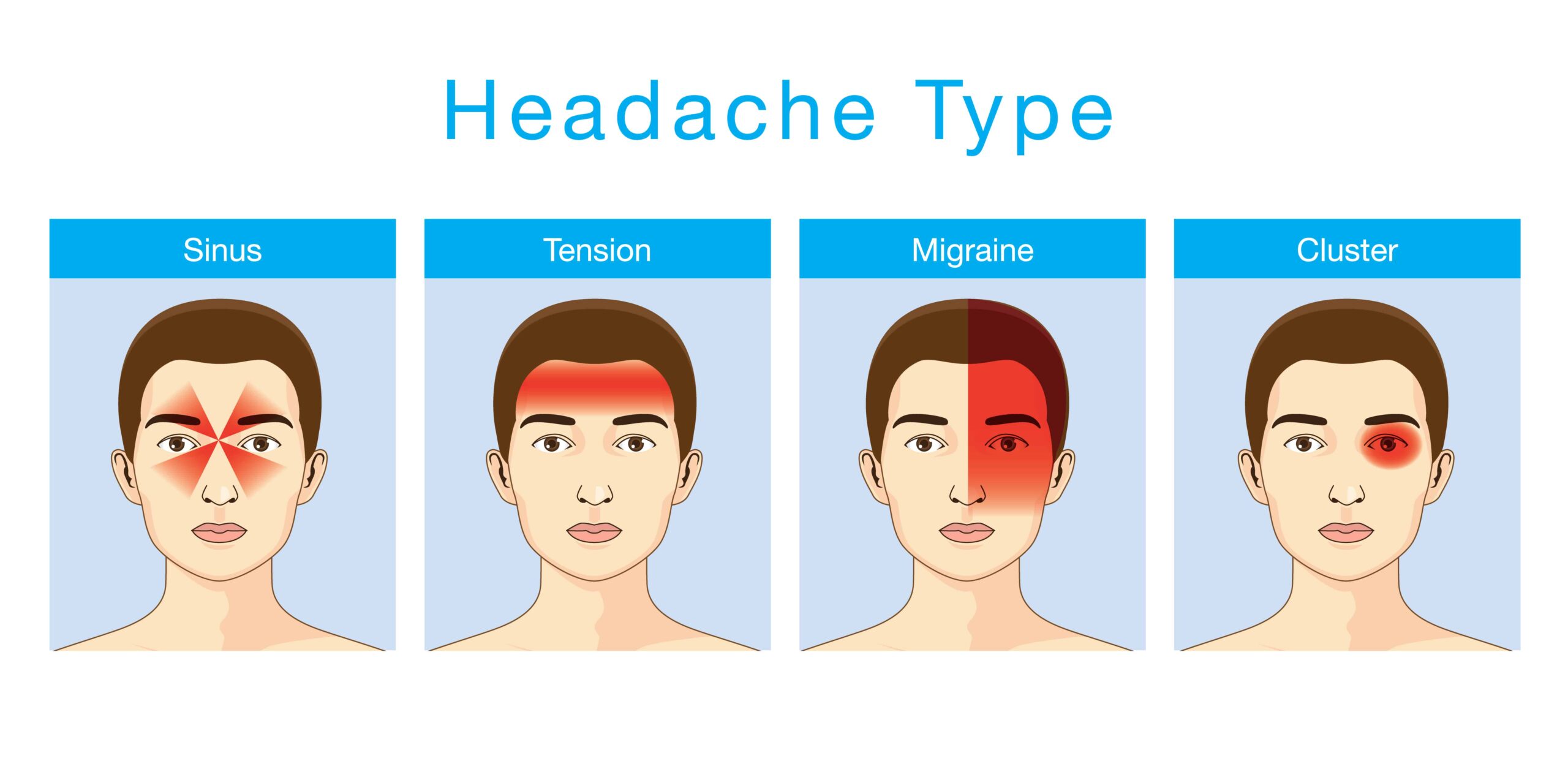 6 Tips To Increase Your VA Rating For Migraines The Definitive Guide 