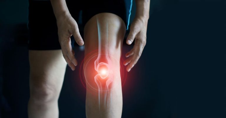 Understanding the VA Knee Rating Chart (The Ultimate Guide)