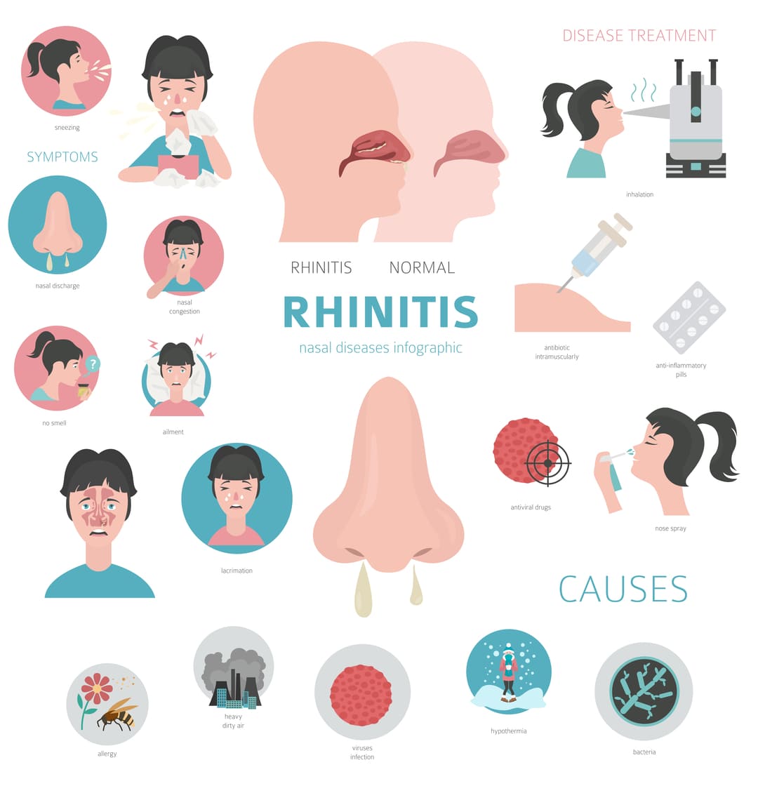 Top 5 Tips For a Chronic Rhinitis VA Rating
