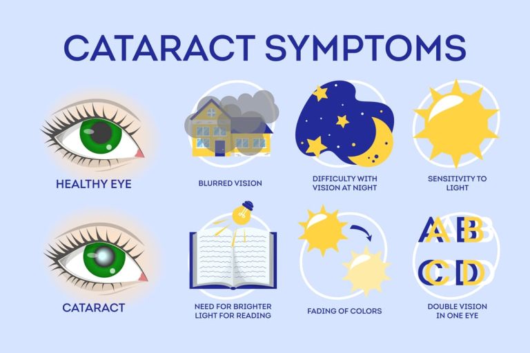 VA Cataract Surgery and VA Ratings