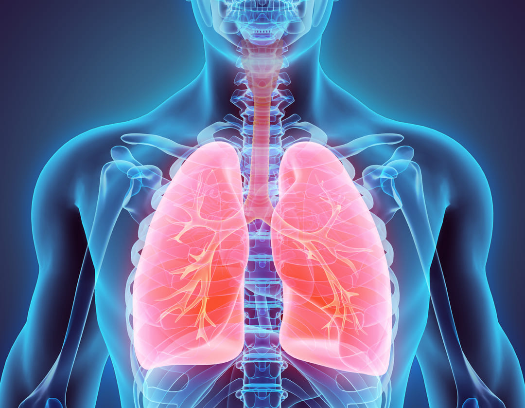 How to Win a Dyspnea VA Rating
