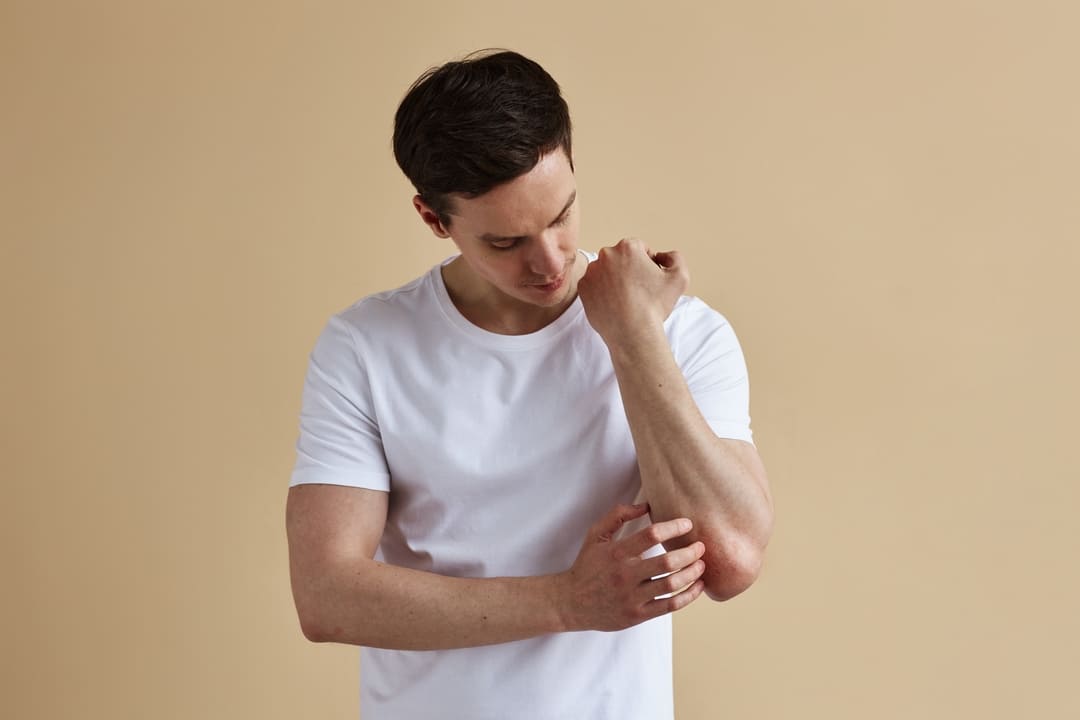 How to Win a Dermatitis VA Rating