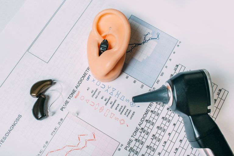 How to Secure a Hearing Loss VA Rating (0-100%)